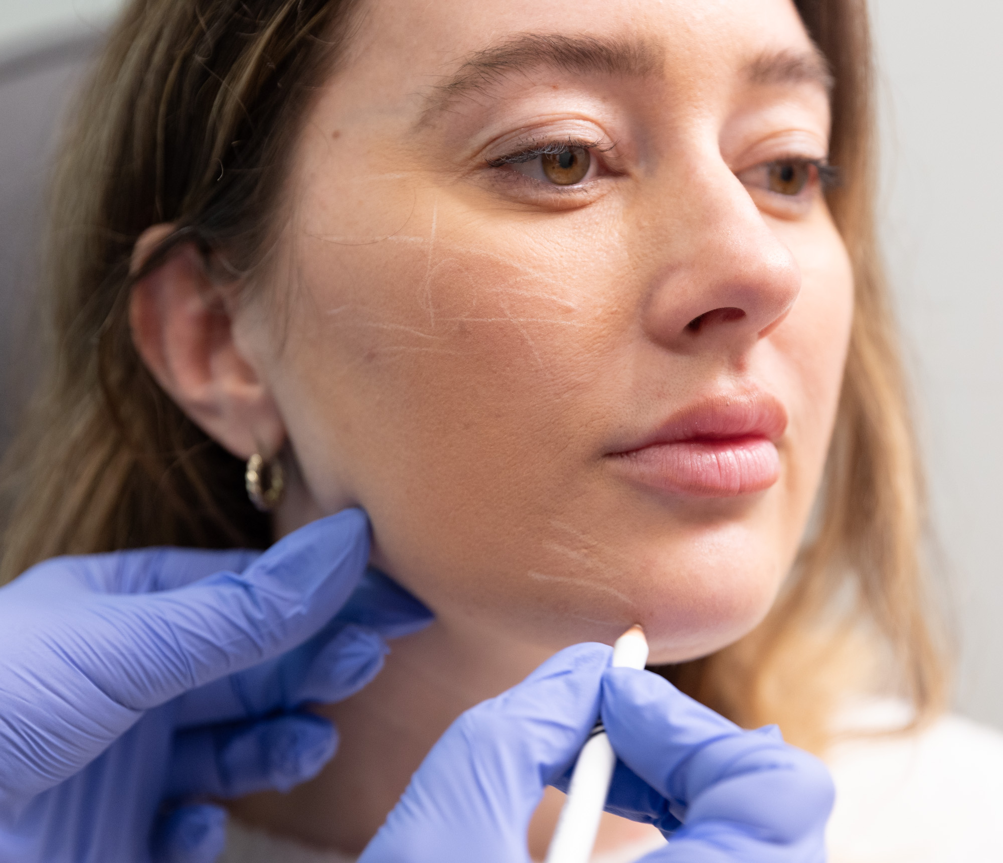 Facelift in Traverse City | Copper Aesthetics & Plastic Surgery